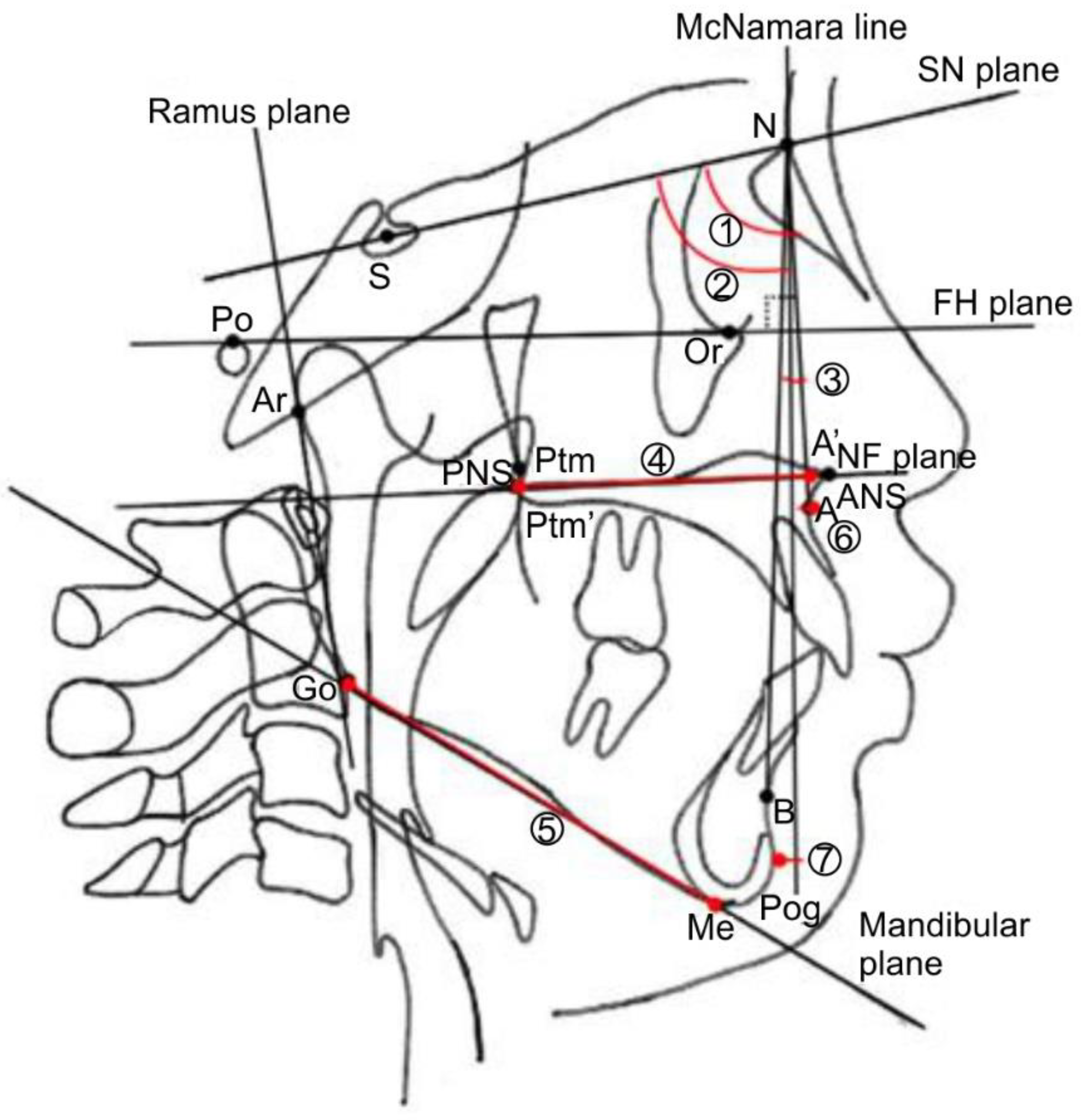A Preliminary Study of Interdisciplinary Approach with a Single-Stage ...