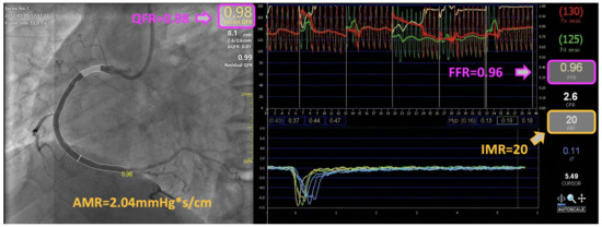 In Vivo Validation of a Novel Computational Approach to Assess ...
