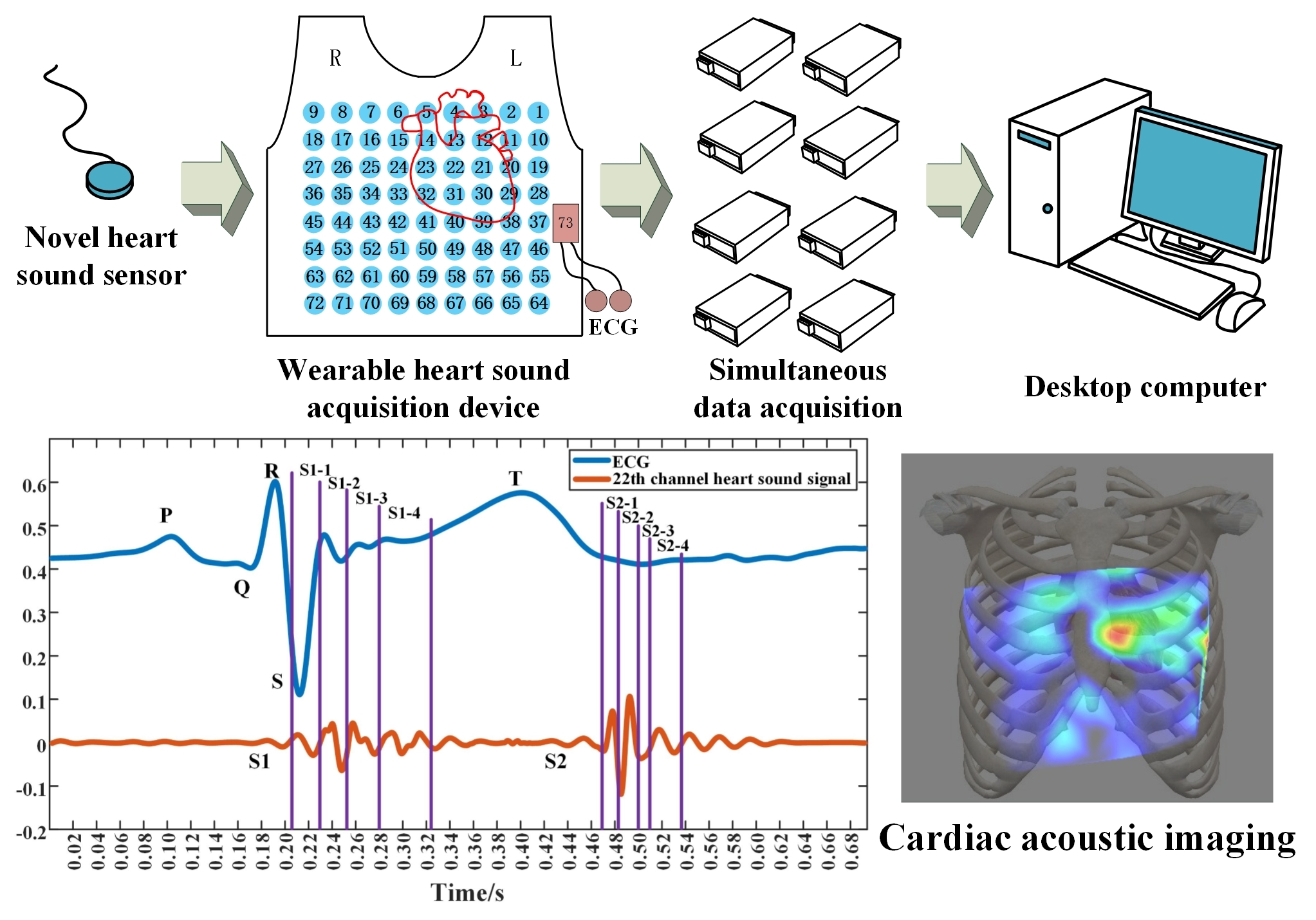 JPM | Free Full-Text | Development of a Multi-Channel Wearable Heart ...