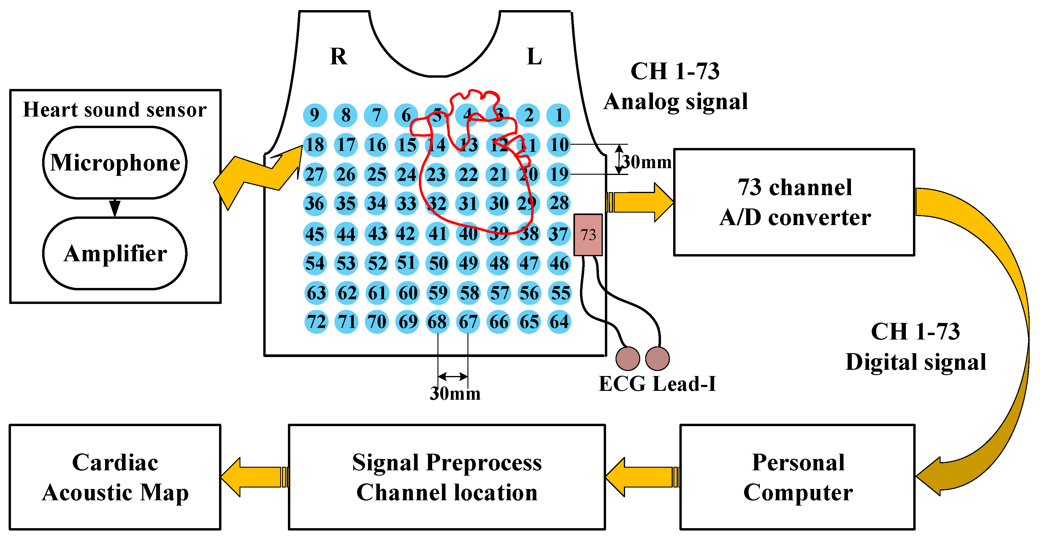 Development of a Multi-Channel Wearable Heart Sound Visualization System