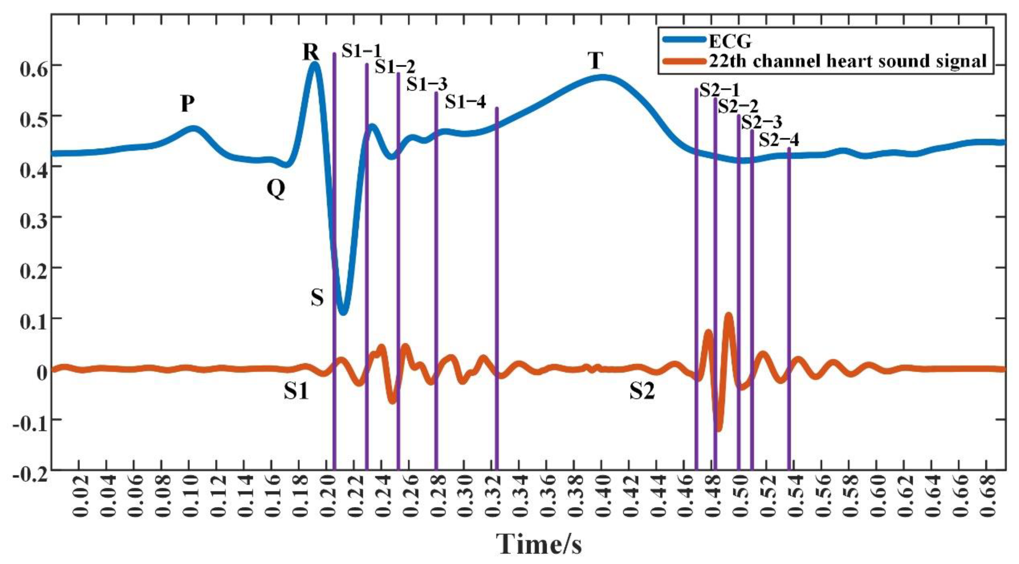Development of a Multi-Channel Wearable Heart Sound Visualization System