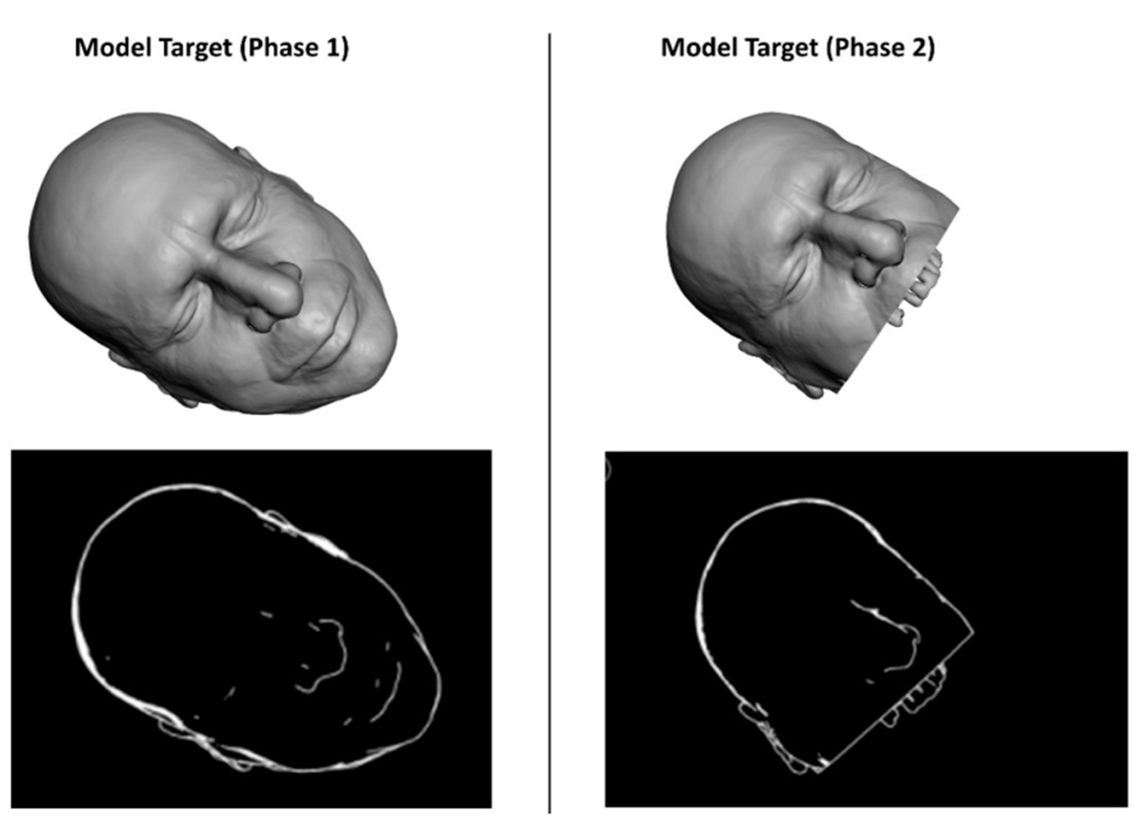 Application of Augmented Reality to Maxillary Resections: A Three ...