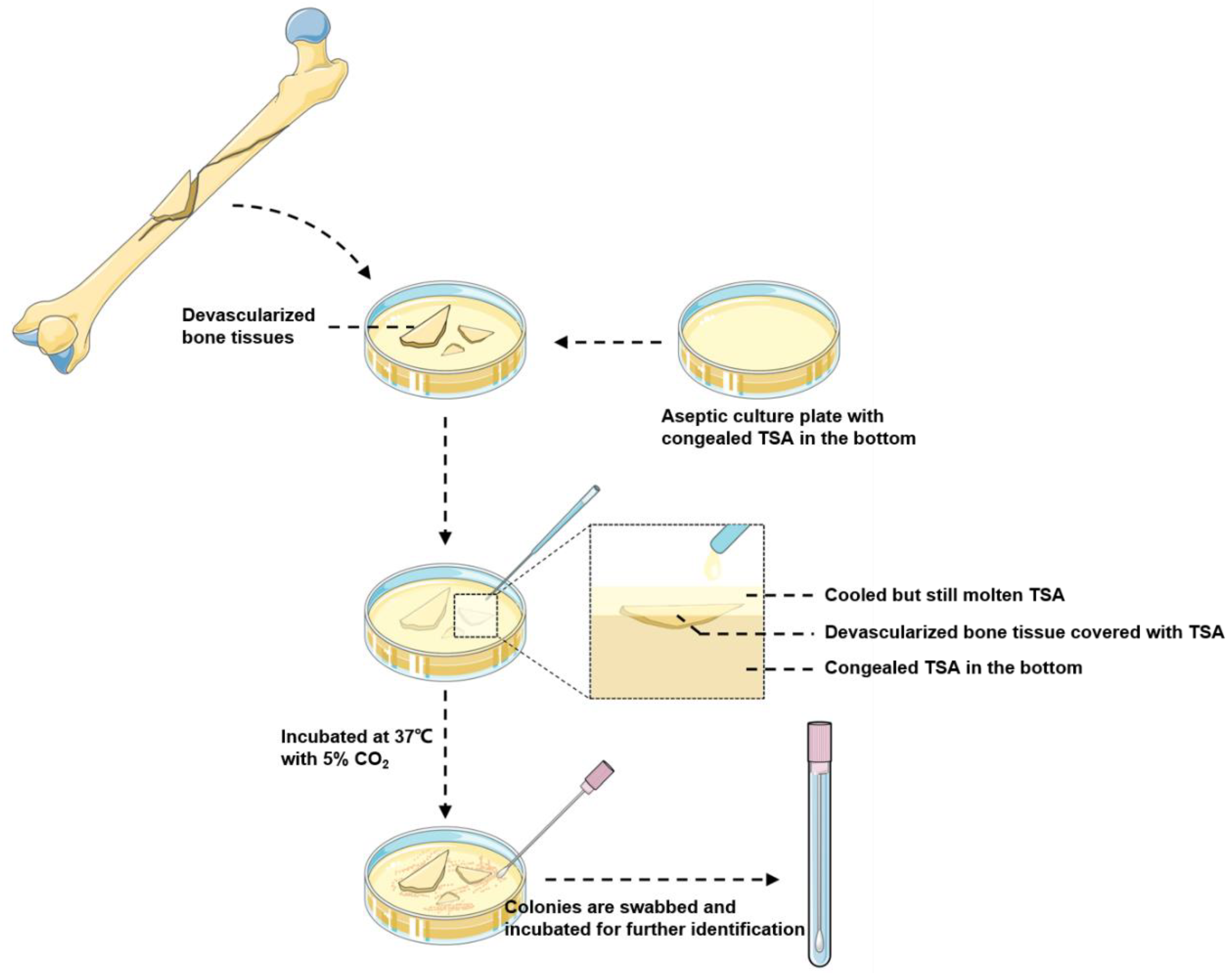 Devascularized Bone Surface Culture: A Novel Strategy for Identifying ...