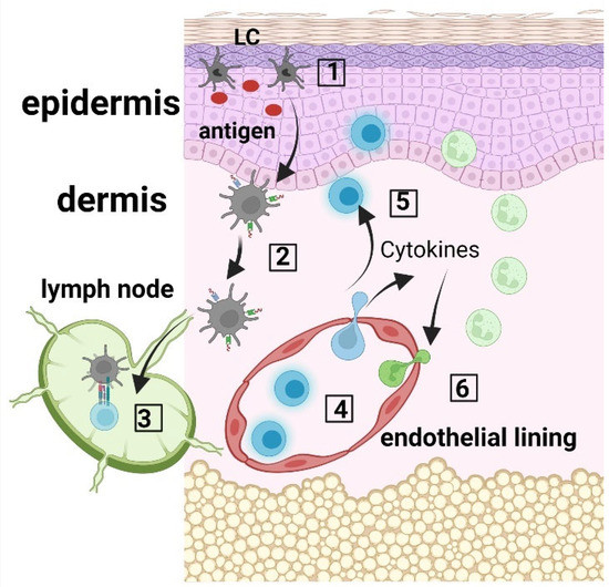 Langerhans Cells—Revising Their Role in Skin Pathologies