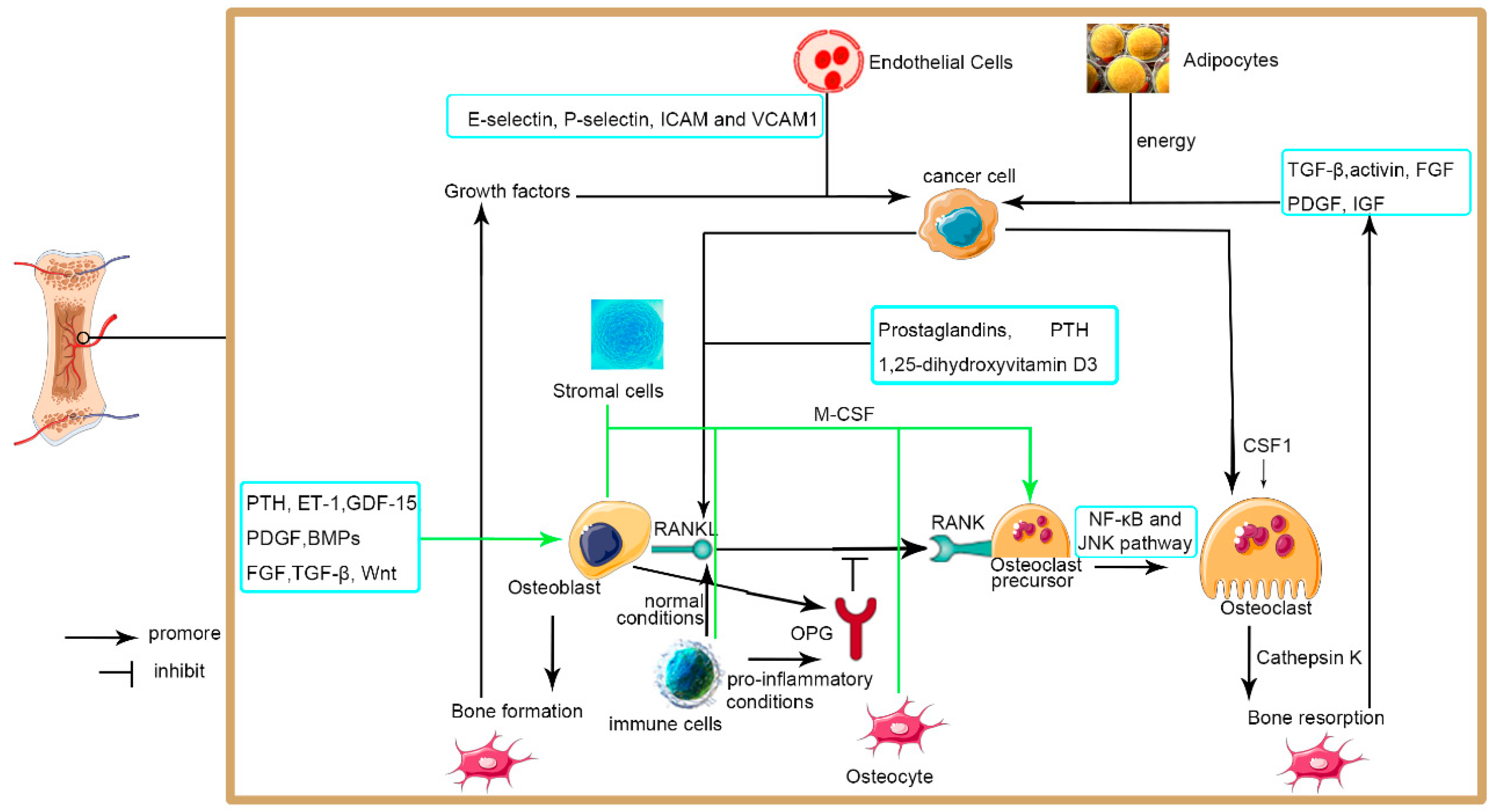 Bone Metastasis in Bladder Cancer