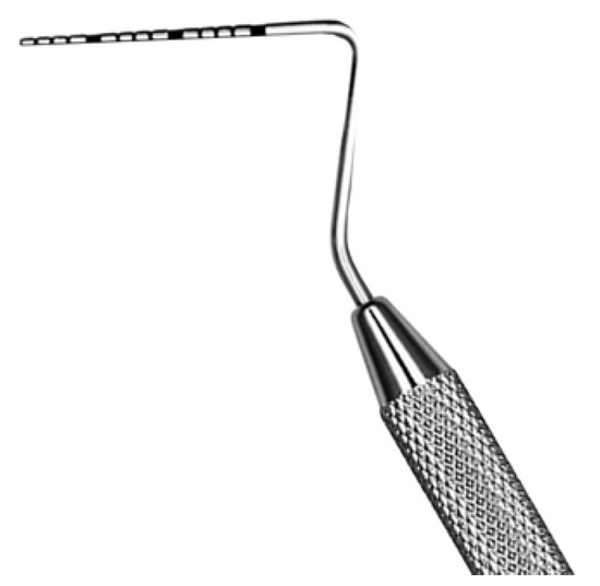 Evaluation of a Novel Technique for Closure of Small Palatal Fistula