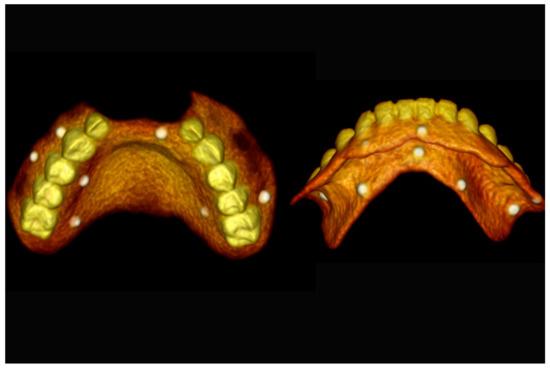 Computer-Aided Design and Computer-Aided Modeling (CAD/CAM) for Guiding ...