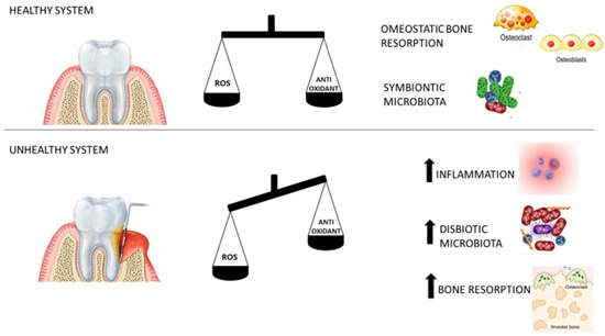 The Emerging Role of Salivary Oxidative Stress Biomarkers as Prognostic ...