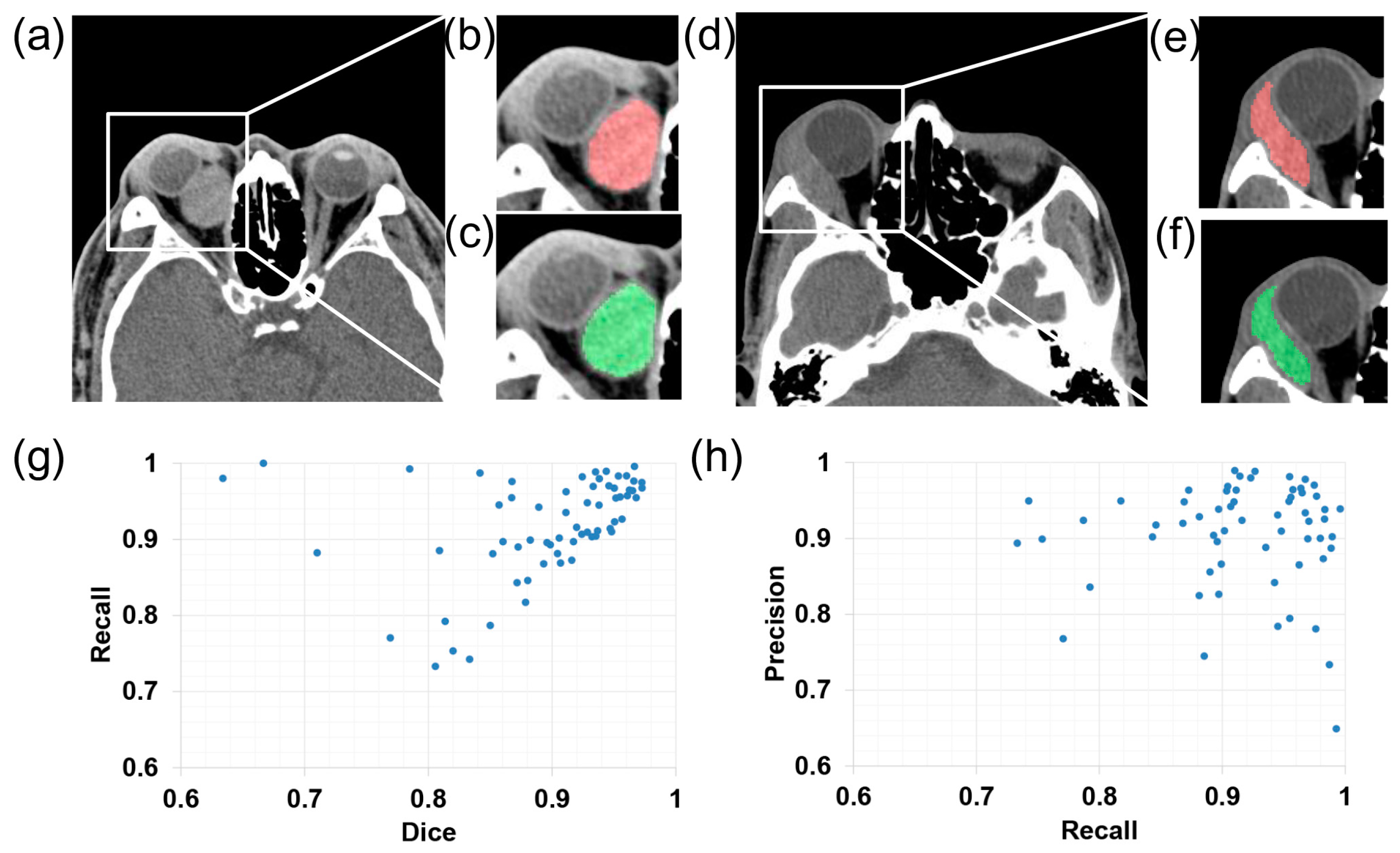 End-to-End Deep-Learning-Based Diagnosis of Benign and Malignant ...