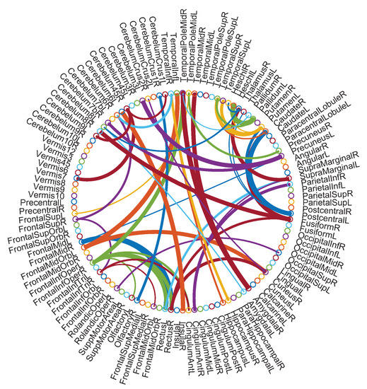 Fusing Multiview Functional Brain Networks by Joint Embedding for Brain Disease Identification