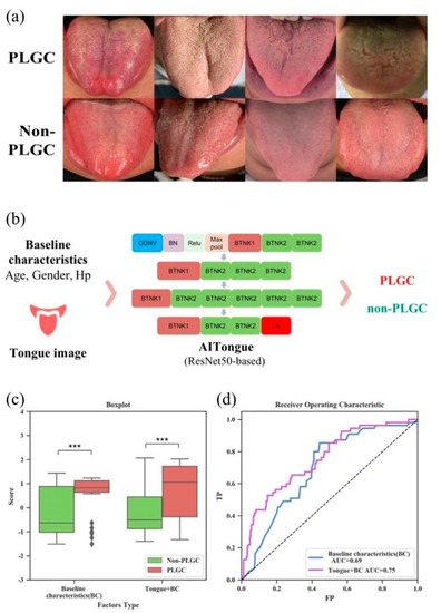 Construction of Tongue Image-Based Machine Learning Model for Screening ...