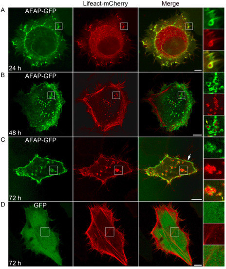JPM | Free Full-Text | Enhancement of Cell Adhesion by Anaplasma ...