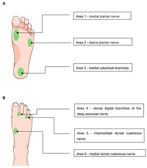 Effect of Surgical Release of Entrapped Peripheral Nerves in ...