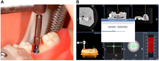Proposal and Validation of a New Nonradiological Method for ...