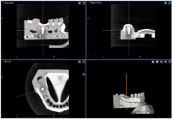 Proposal and Validation of a New Nonradiological Method for ...