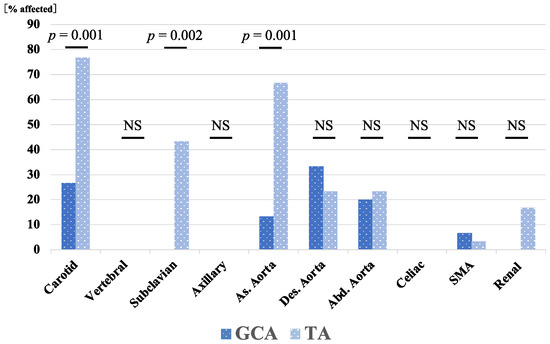 Clinical Features and Outcomes of Japanese Patients with Giant Cell ...