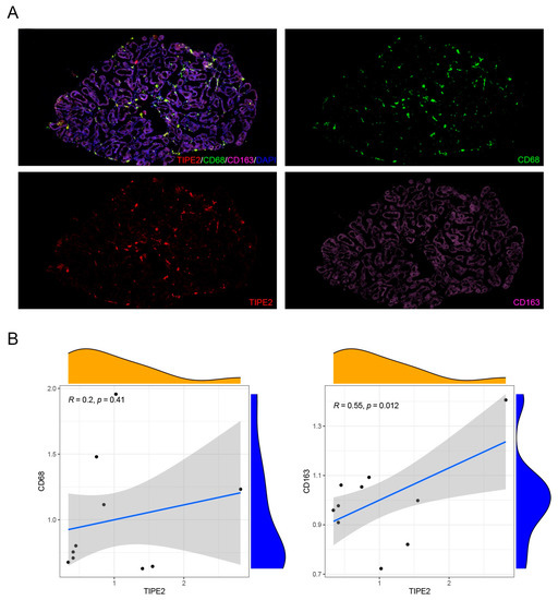 TIPE2 Inhibits MGD Inflammation by Regulating Macrophage Polarization