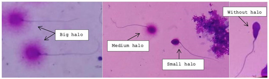 JPM | Free Full-Text | How Well Do Semen Analysis Parameters Correlate ...