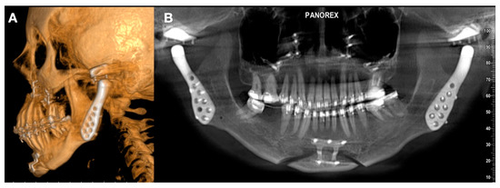 An Overview of Clinical Conditions and a Systematic Review of ...