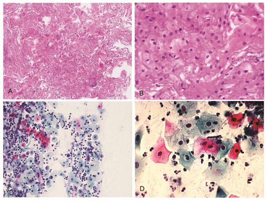 The Association of Four Natural Molecules—EGCG, Folic Acid, Vitamin B12 ...