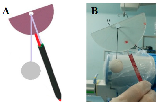 O-Arm- and Guide-Device-Assisted Personalized Percutaneous Kyphoplasty ...