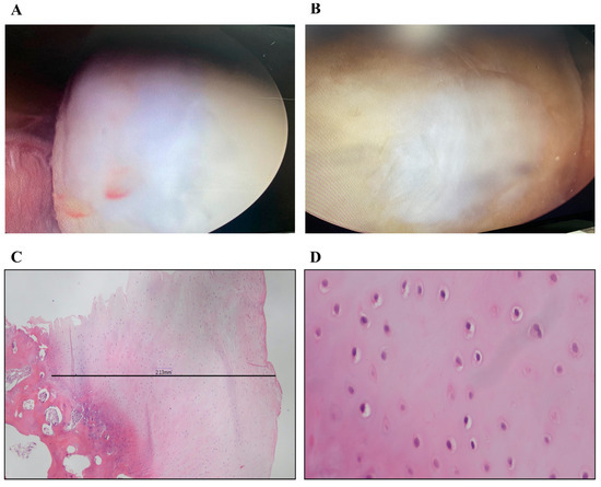 The Evaluation of Cartilage Regeneration Efficacy of Three ...