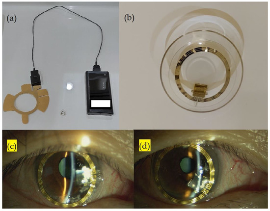 Circadian Fluctuation Changes in Intraocular Pressure Measured Using a ...
