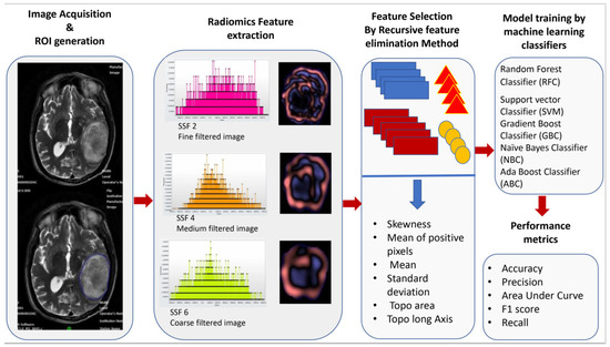 Machine-Learning-Based Radiomics for Classifying Glioma Grade from Magnetic Resonance Images of ...