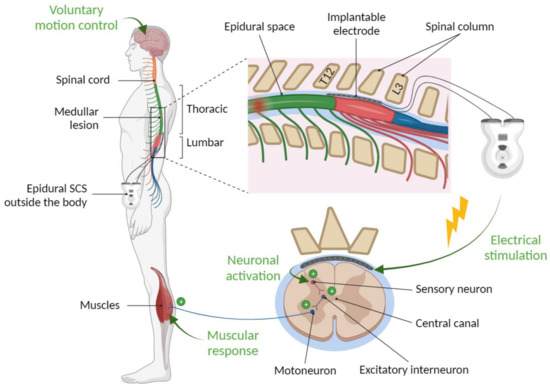 Advances in Spinal Cord Neuromodulation: The Integration of Neuroengineering, Computational ...