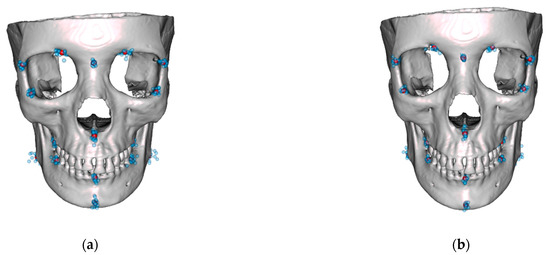 Cross Sectional Analysis of Eurasian Skull Anatomy for 3D Cephalometry ...
