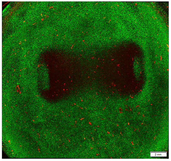In Vitro Models for Improved Therapeutic Interventions in Atrial ...