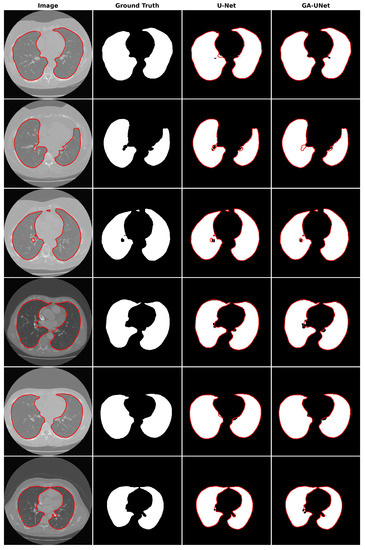 JPM | Free Full-Text | Medical Image Segmentation Using Automatic ...