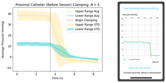 Implantable Intracranial Pressure Sensor with Continuous Bluetooth ...