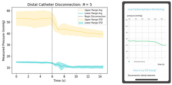 Implantable Intracranial Pressure Sensor with Continuous Bluetooth ...