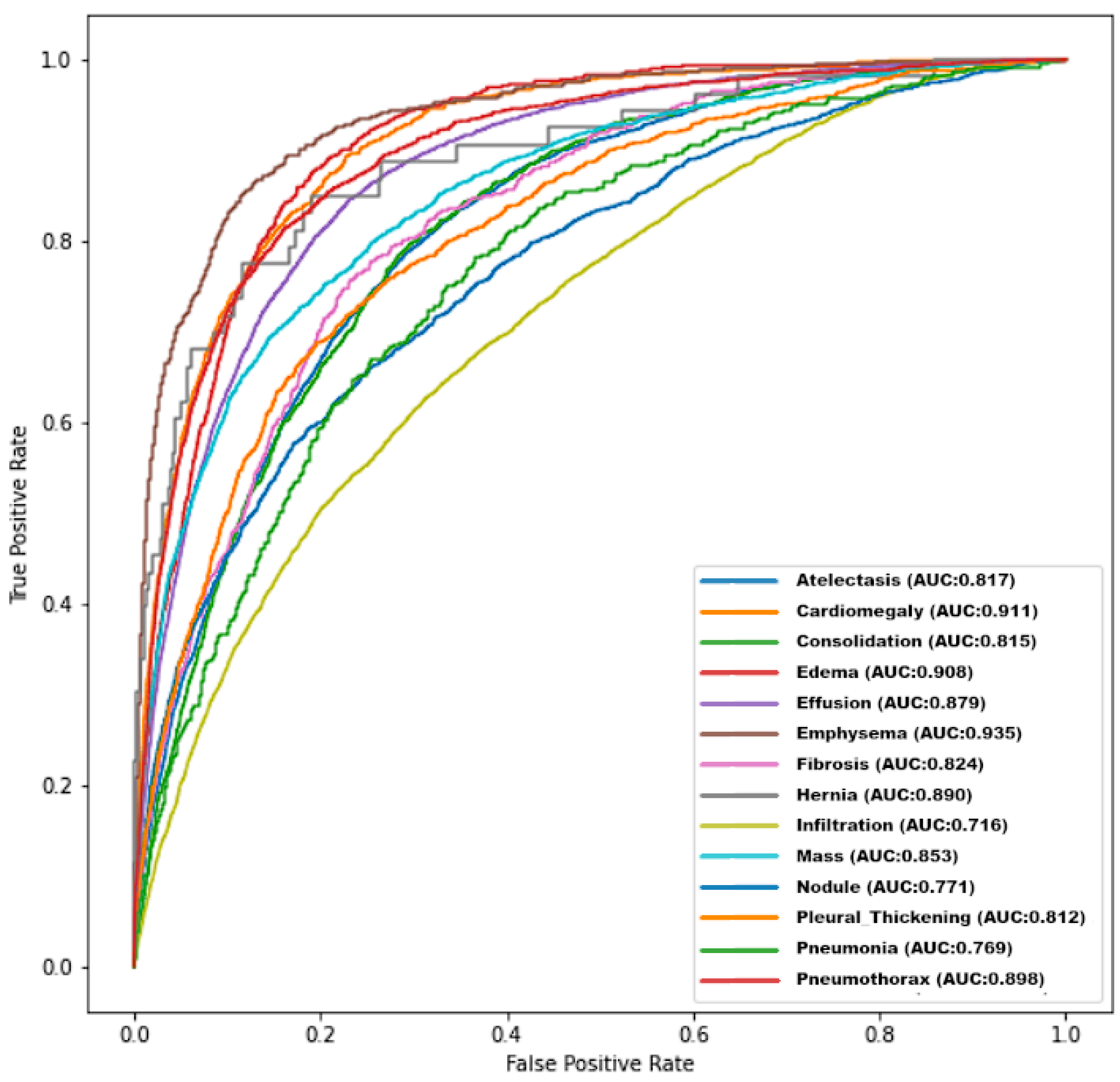 JPM | Free Full-Text | Multi-Label Classification of Chest X-ray Abnormalities Using Transfer ...