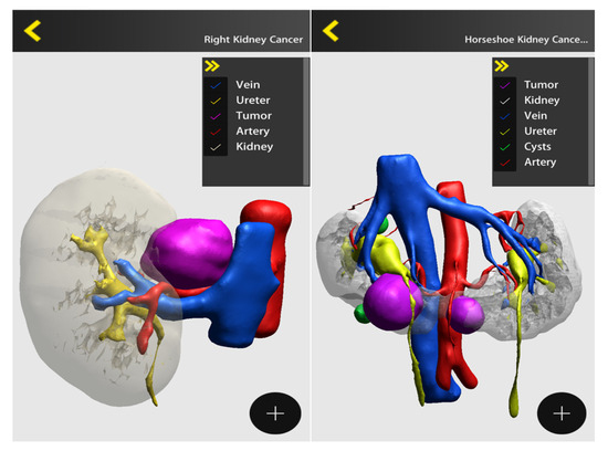 Three-Dimensional Customized Imaging Reconstruction for Urological ...