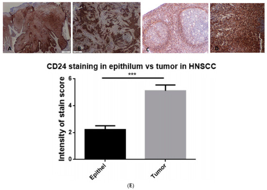 CD24 in Head and Neck Malignancies—An Uprising Biomarker?