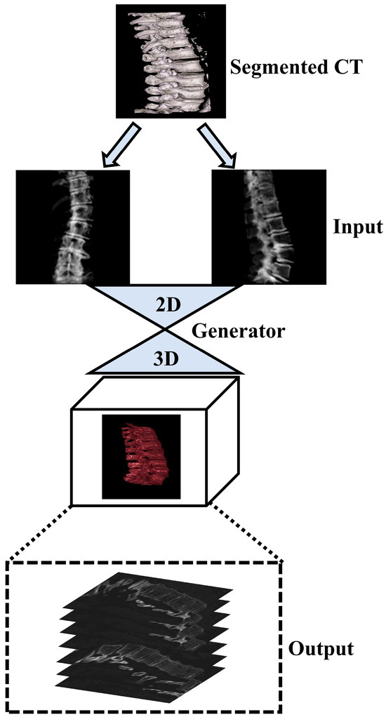 Synthetic 3D Spinal Vertebrae Reconstruction from Biplanar X-rays ...