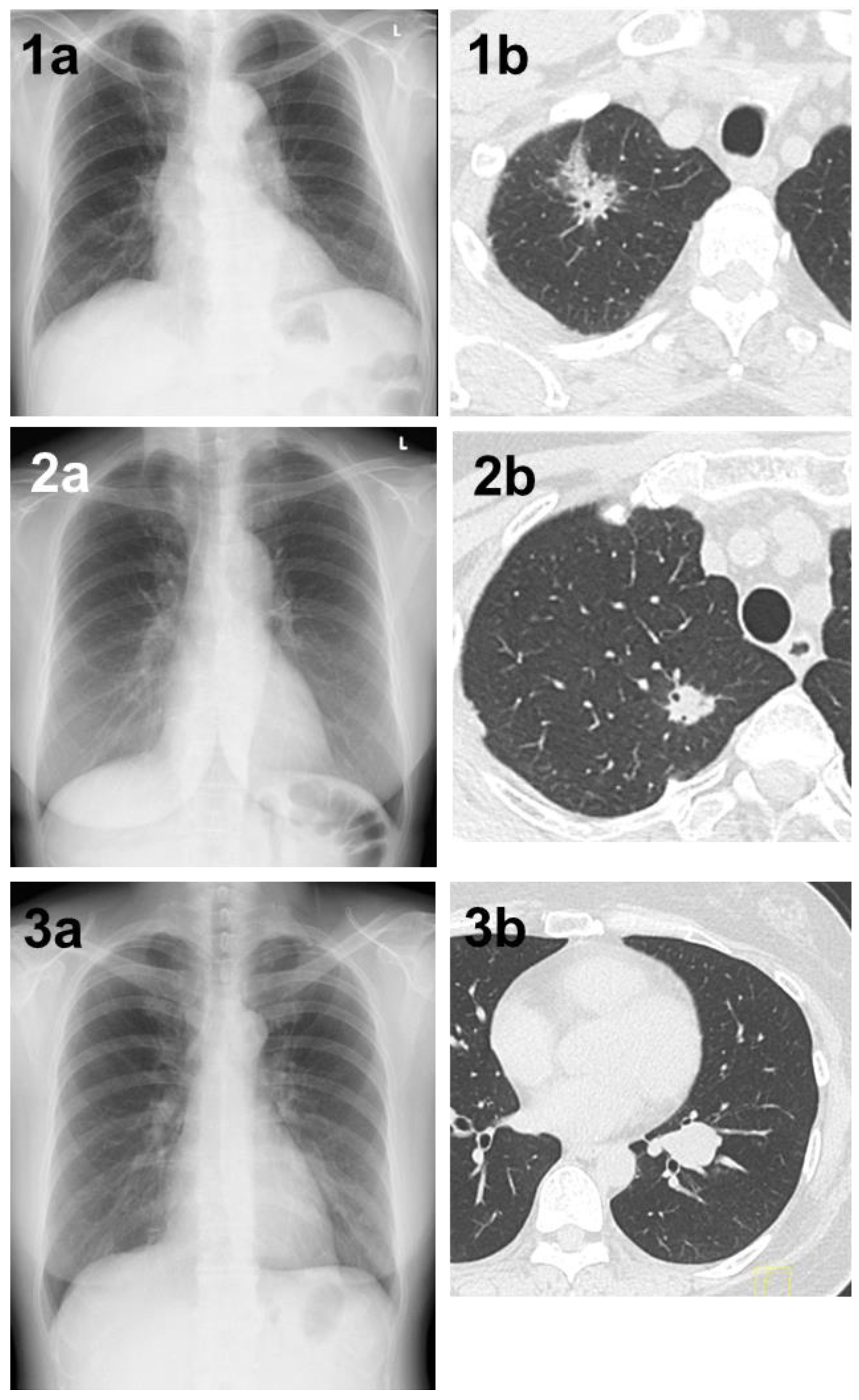 JPM | Free Full-Text | Can Artificial Intelligence Replace Humans for ...