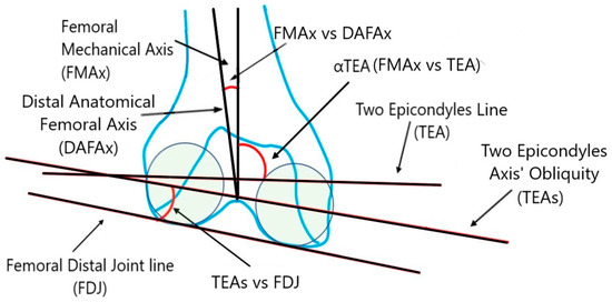 Only 26% of Native Knees Show an Identical Coronal Functional Knee ...