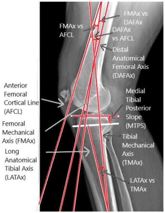 Only 26% of Native Knees Show an Identical Coronal Functional Knee ...