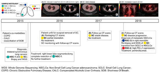 Genome Sequencing of Multiple Primary Lung Cancers Harbouring Mixed ...