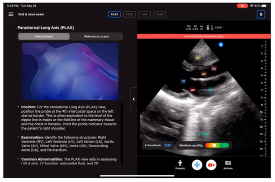 Ultrasonographic Applications of Novel Technologies and Artificial Intelligence in Critically ...