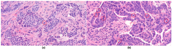 JPM | Free Full-Text | Digital Validation in Breast Cancer Needle ...