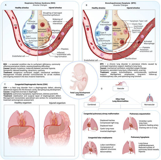 Association of Fetal Lung Development Disorders with Adult Diseases: A ...