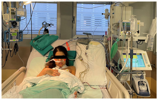 JPM | Free Full-Text | New Insight into Laryngo-Tracheal Surgery: High ...