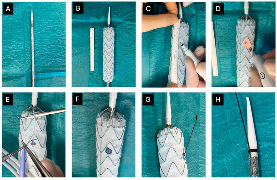 Physician-Modified Endografts for Repair of Complex Abdominal Aortic ...