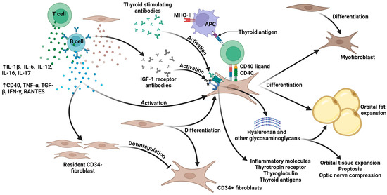 Thyroid Eye Disease: Advancements in Orbital and Ocular Pathology ...
