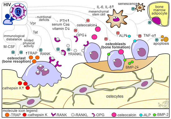 Bone Tissue Changes in Individuals Living with HIV/AIDS: The Importance ...