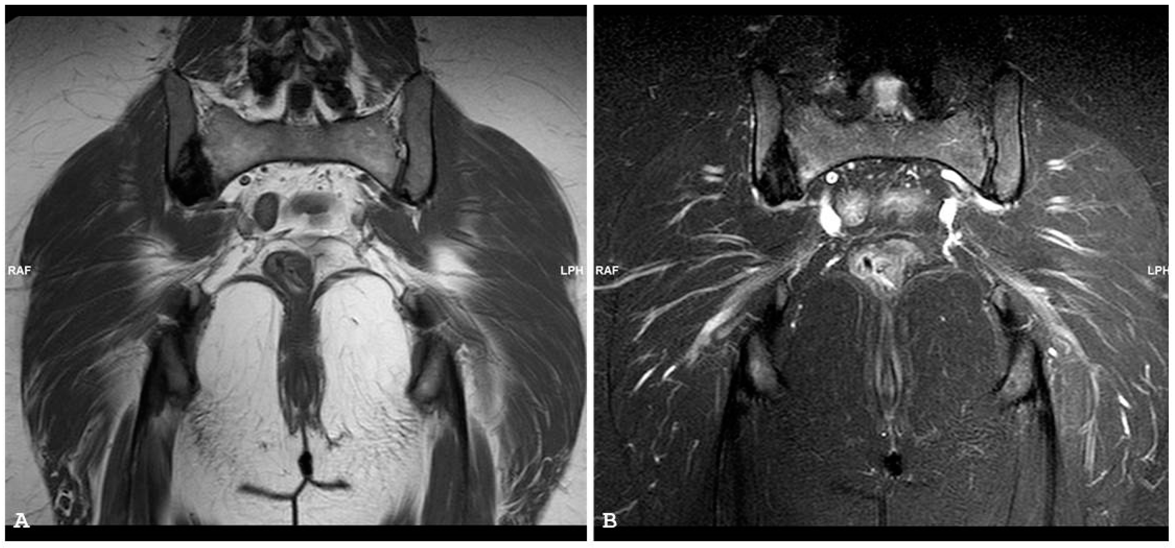 Imaging of Sacroiliac Pain: The Current State-of-the-Art